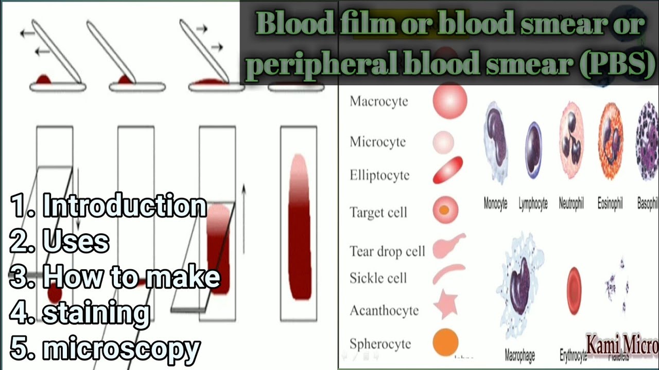 Blood film or smear or peripheral blood smear: how to make: Uses ...
