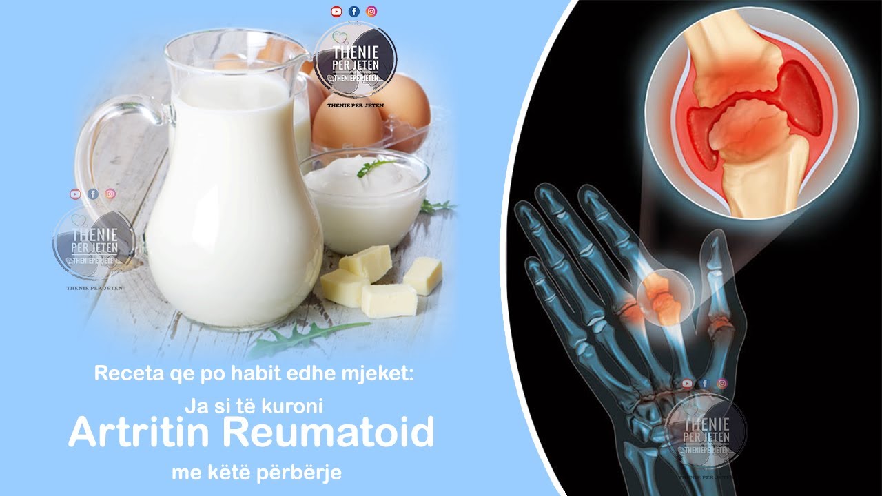Receta qe po habit edhe mjeket: Ja si të kuroni Artritin Reumatoid me ...