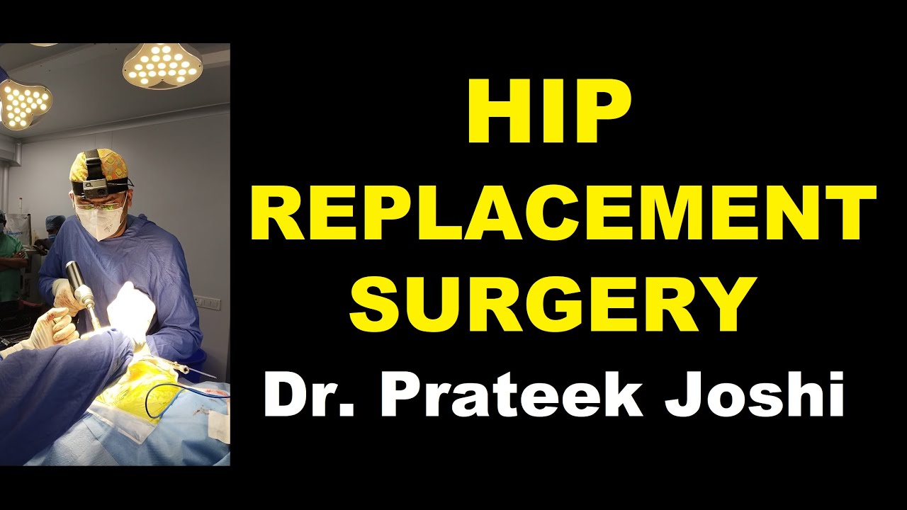 Uncemented Hip Replacement Surgical Video | Posterior Approach Moore ...