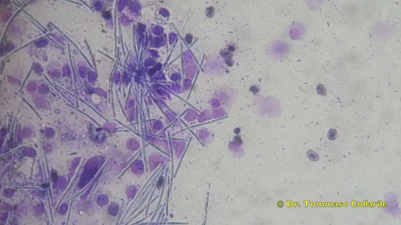 Macrorabdus.mov - YouTube