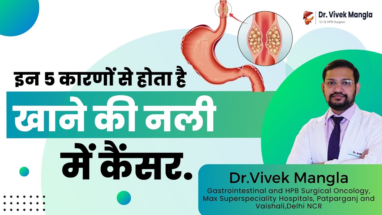 भोजन नली का कैंसर: कारण और जोखिम | Esophageal Cancer Risk Factors ...