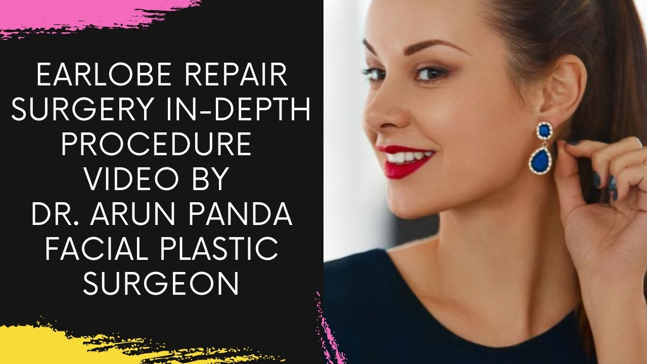 Earlobe Repair Surgery in-depth procedure video by Dr. Arun Panda ...