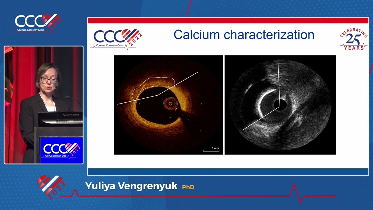 Intravascular Imaging IVUS, OCT and NIRS - Yuliya Vengrenyuk, PhD - YouTube