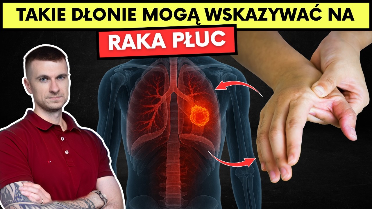 Pierwsze objawy raka płuc, które możesz zauważyć w lustrze - YouTube