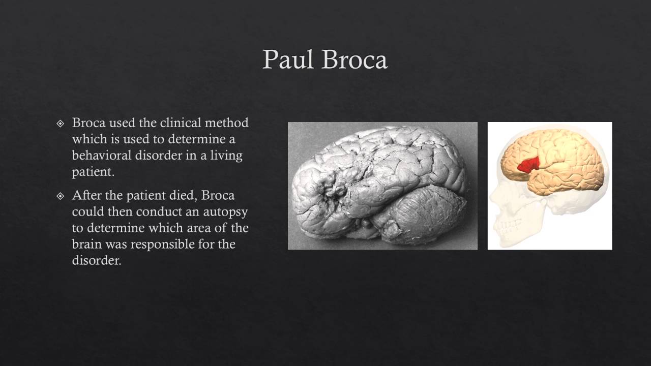 Franz Joseph Gall vs Paul Broca: Brain Functions - YouTube