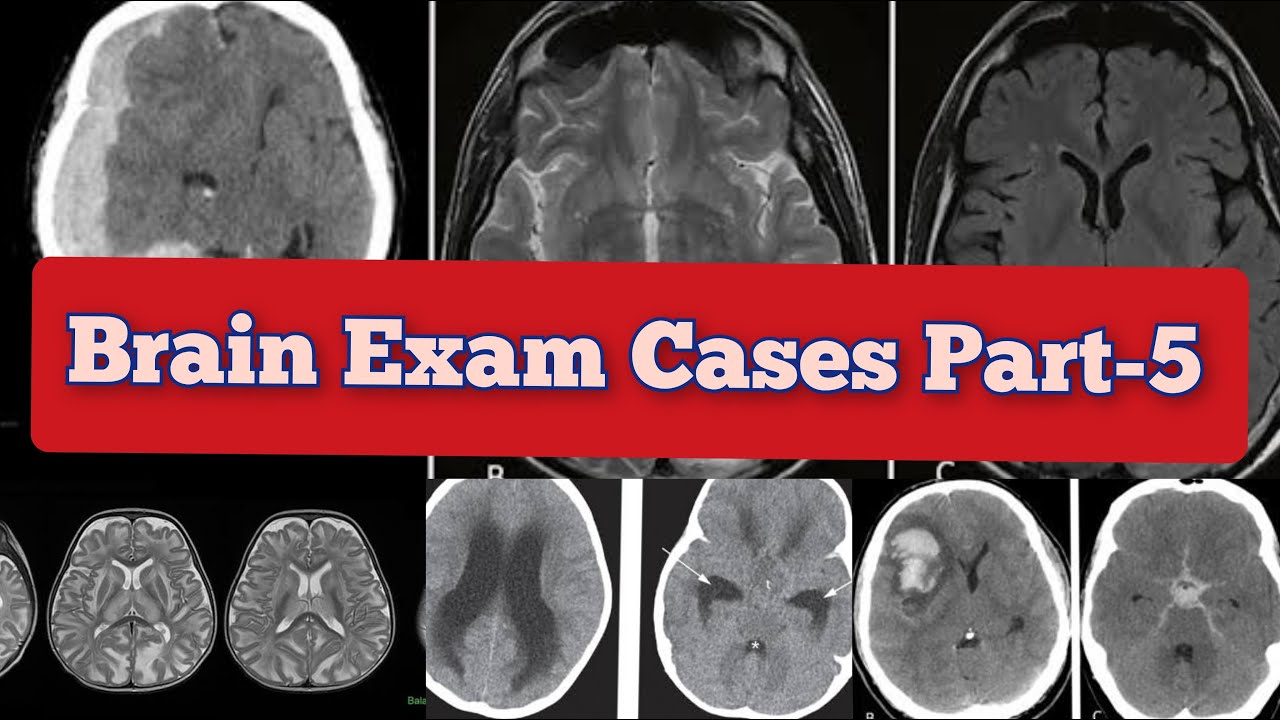 Radiology Viva Cases # 357- 366 | Brain Exam Cases Part -5 #medical # ...