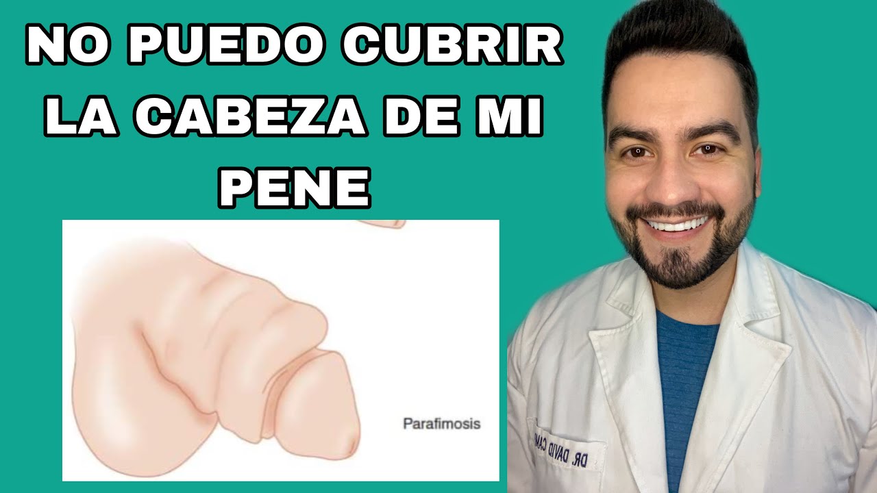 QUE ES LA PARAFIMOSIS? | DR. DAVID CAMPOS - YouTube