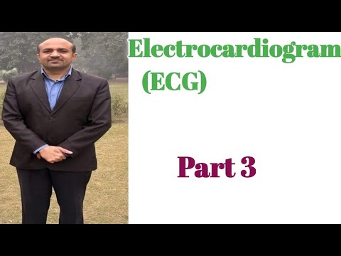 Electrocardiogram (ECG):::Limb Leads.Einthoven Triangle..Positive and ...