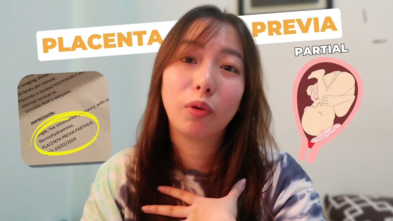 PREGNANCY JOURNEY, DIAGNOSED WITH PLACENTA PREVIA (MABABA ANG INUNAN ...