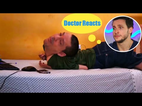 Doctor Mike Reacts To Rarest Diseases 😢 | Body Bizarre - YouTube