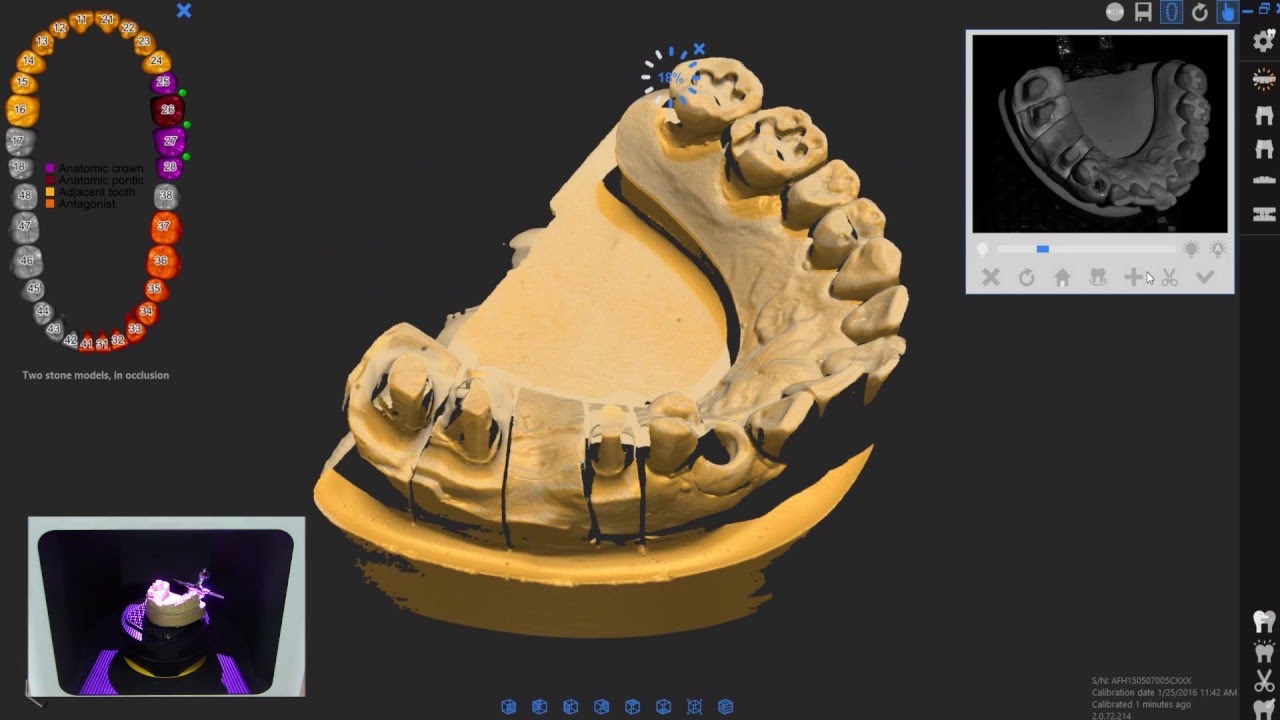 DOF Freedom HD - Dental Scanner (4-Unit Bridge) - YouTube