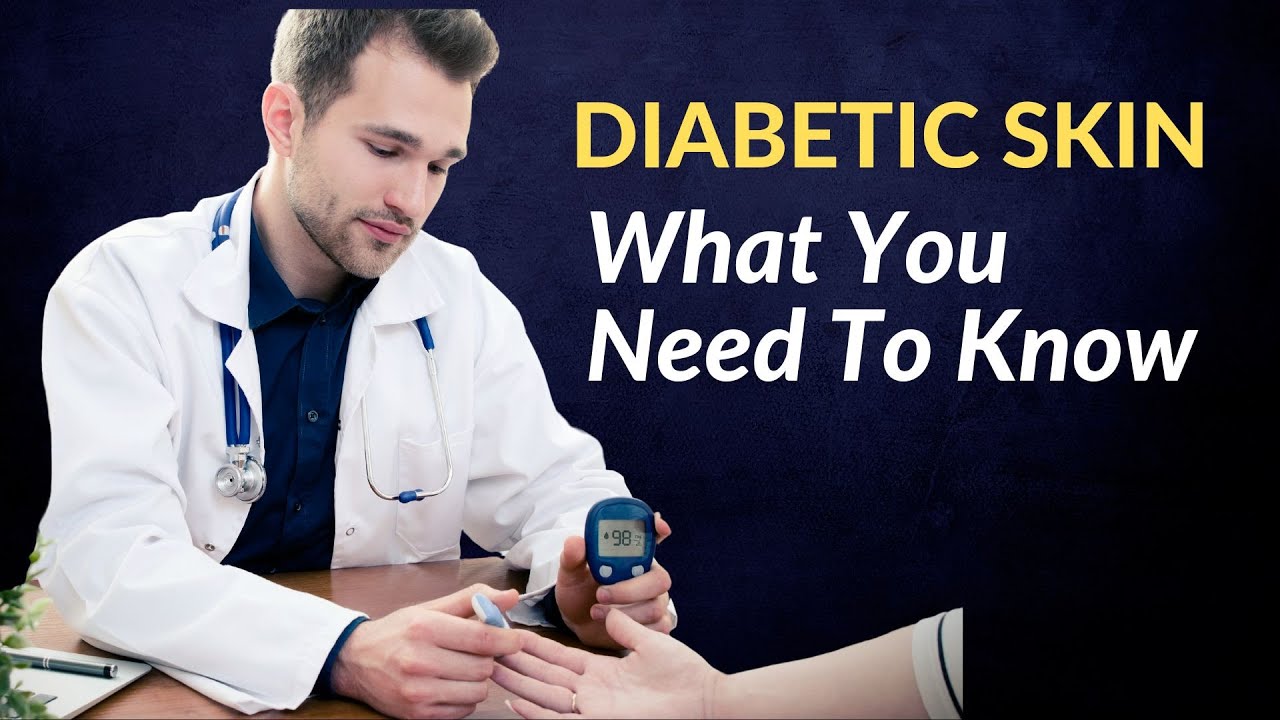 Diabetic Skin Problems | What YOU Need to Know! - YouTube