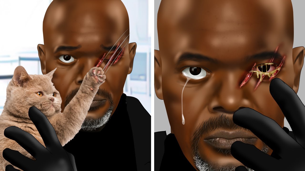 [ASMR Animation] Be careful when playing with cats | Eye Treatment ...