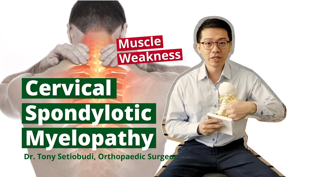CERVICAL SPONDYLOTIC MYELOPATHY SPINAL CORD COMPRESSION - YouTube