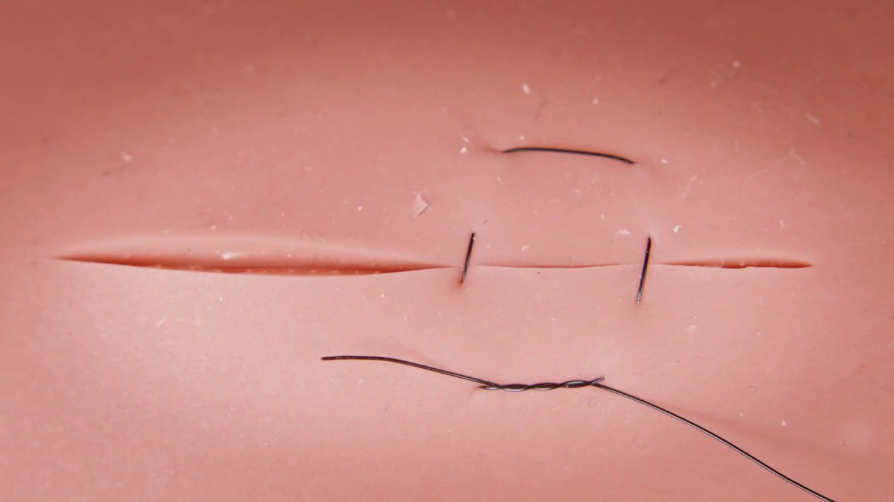 Punto de sutura Halsted - YouTube