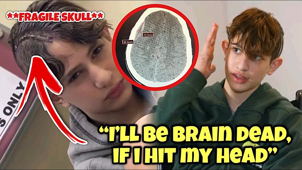 Nidal Wonder Reveals Risky Brain Damage If He HIT his HEAD?! **shocking ...