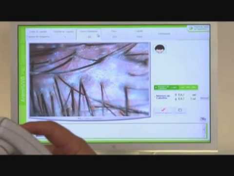 Gain Hair - Diagnostico