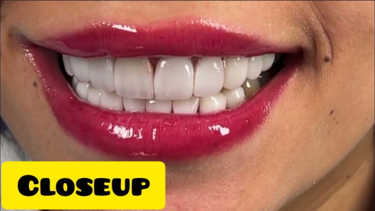 Beautiful smile lips face closeup #teethdesign - YouTube