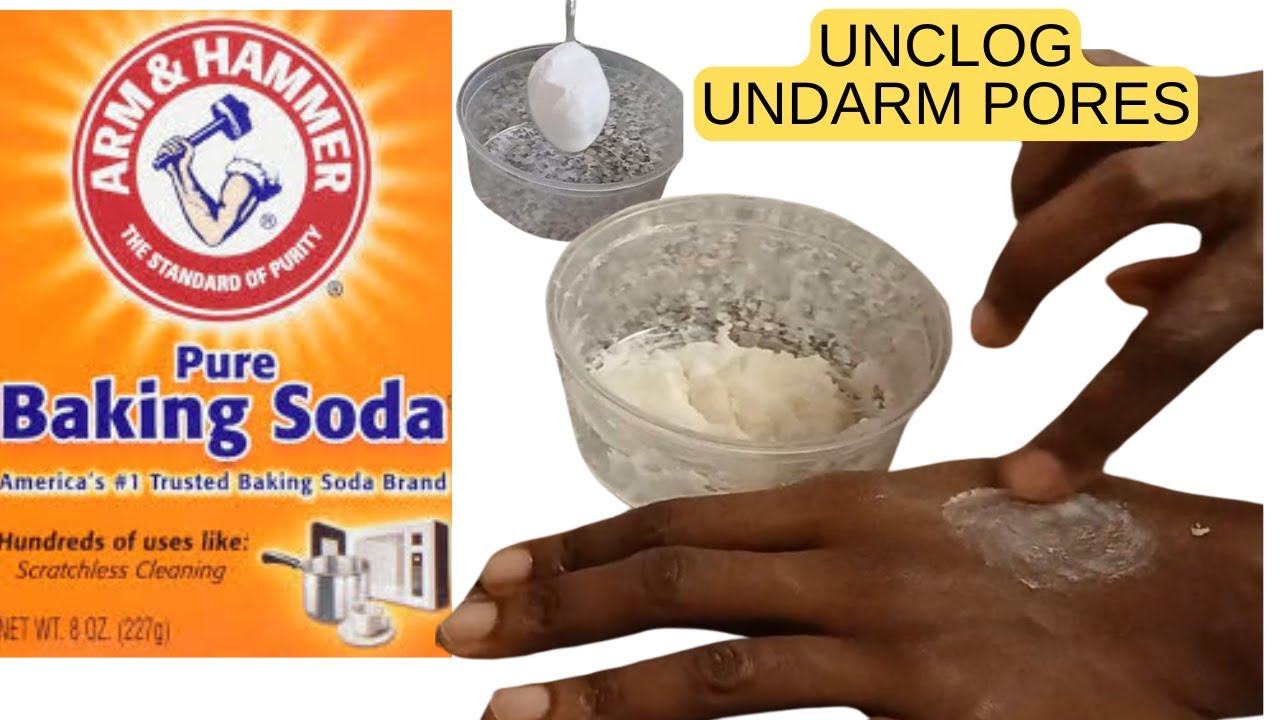 Underarm Blackheads removal | Unclog underarm pores and prevent ...