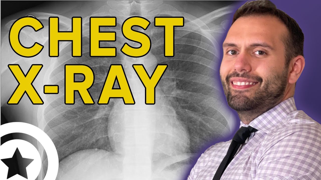 Cardiac Silhouette - Chest X-Ray | HIGH-YIELD CARDIOLOGY | USMLE STEP 1 ...