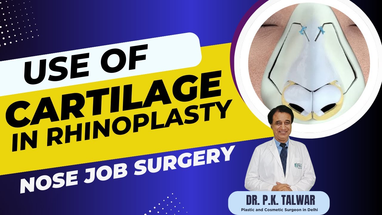 Use Of Cartilage In Rhinoplasty | Nose Reshaping Surgery | Dr PK Talwar - YouTube