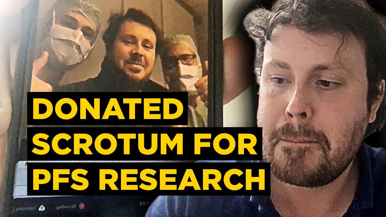 Man DONATED Part Of His SCROTUM For Research Of Post Finasteride man-donated-part-of-his-scrotum-for-research-of-post-finasteride