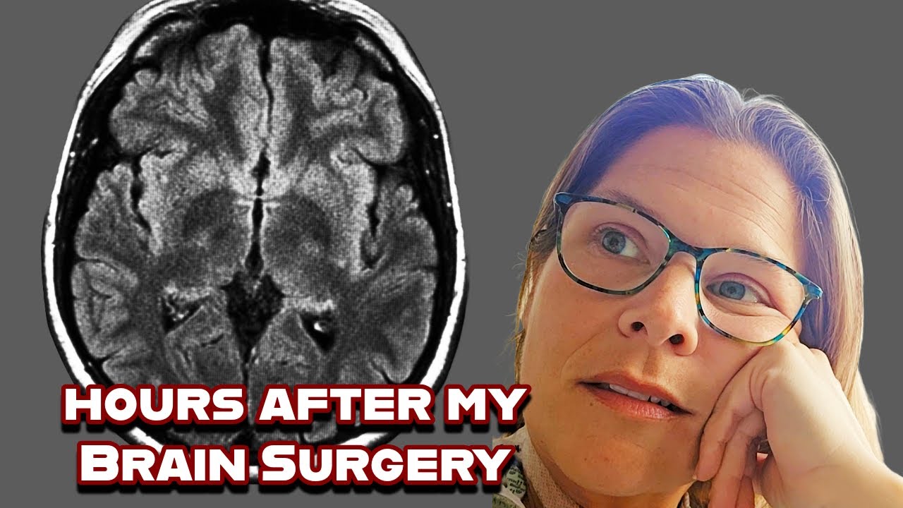 I had brain surgery - YouTube