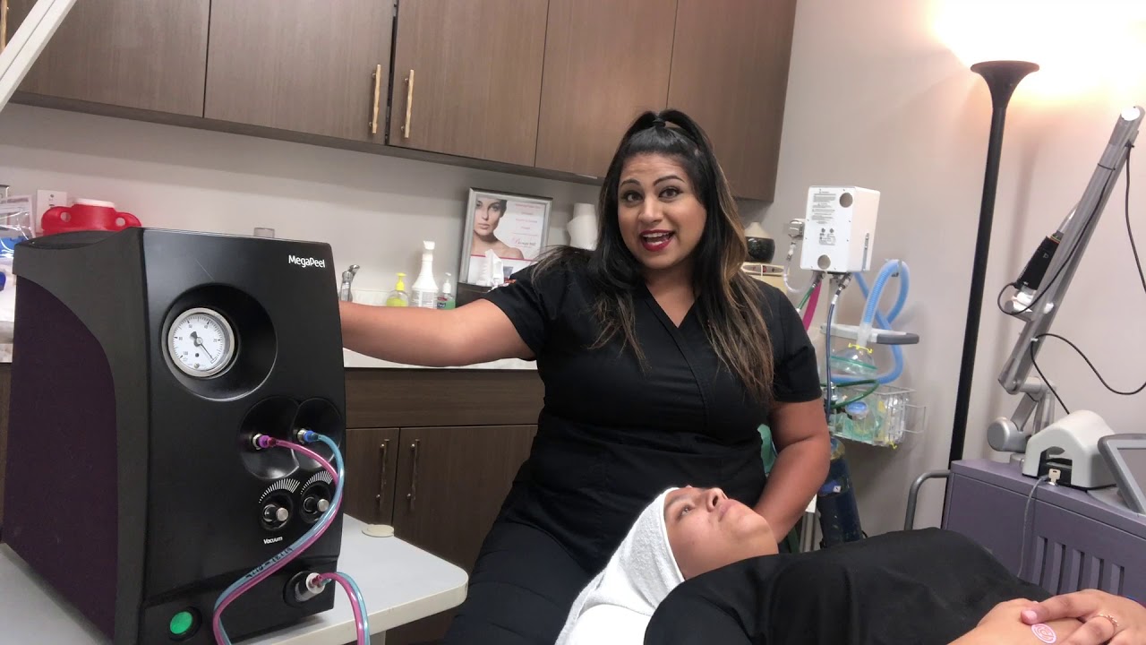 Megapeel at Berman Cosmetic Surgery - YouTube