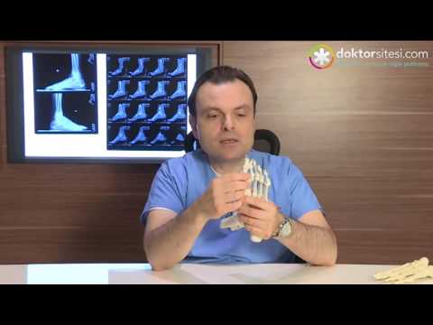 Ayak ve ayak bileği eklem kireçlenmeleri neden oluşur?