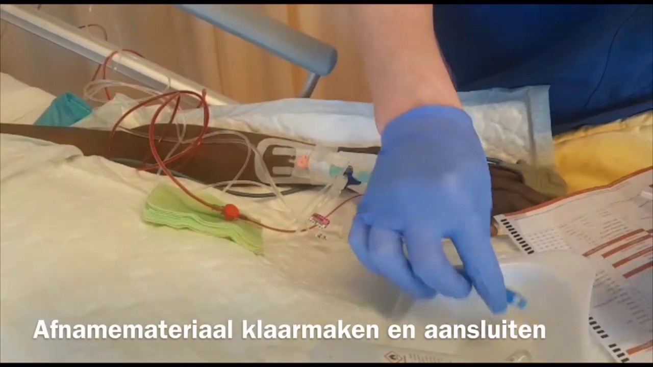 Bloedafname vanuit arterielijn - YouTube