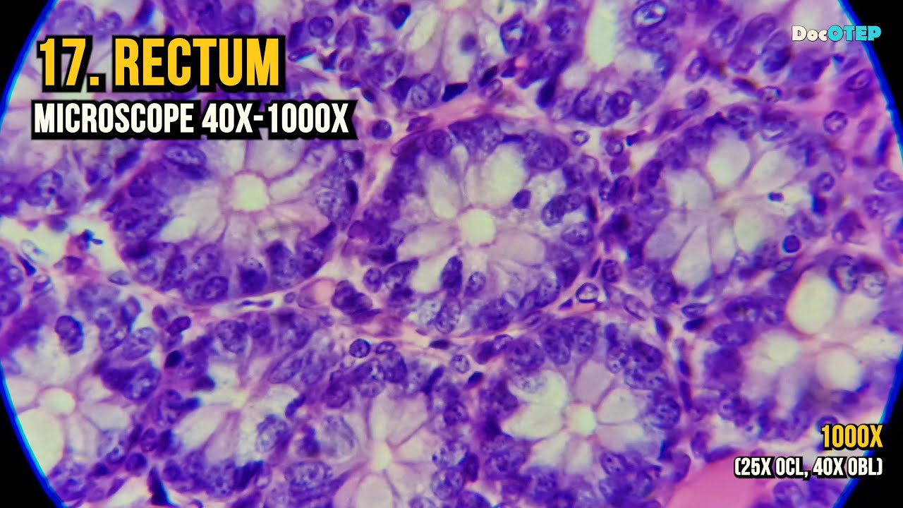 17. Rectum (Microscope 40x-1000x) - YouTube