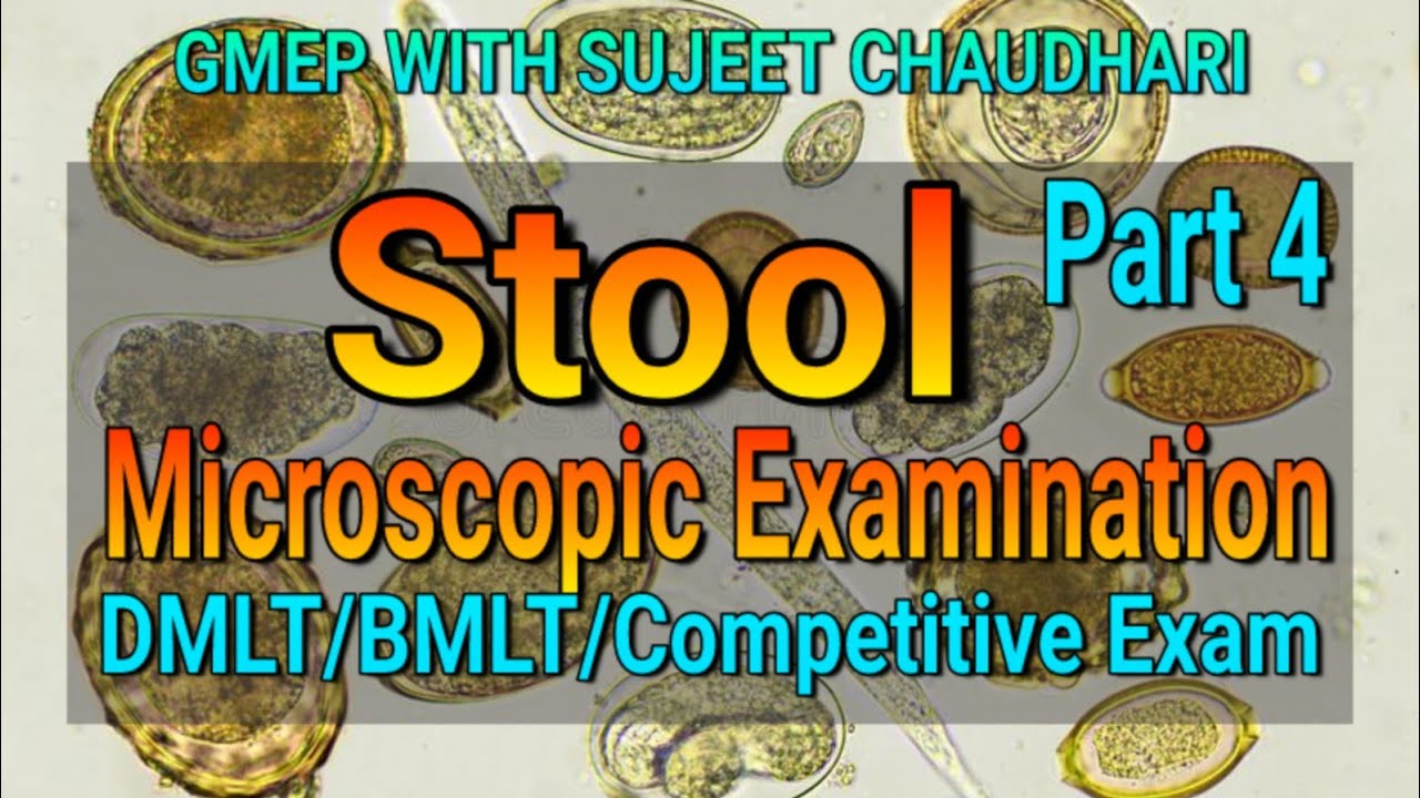 Stool Examination Part 4 | Microscopic Examination | Medical Lab ...