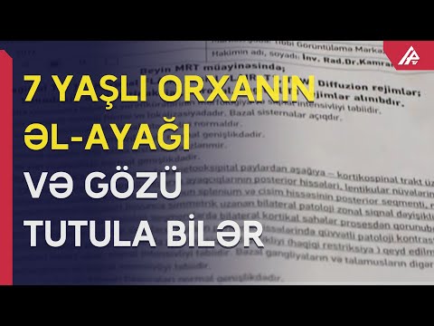 Uşağın yaddaşı da itir, Türkiyədə müalicə mümkündür – AMMA PUL ÇATMIR – APA TV