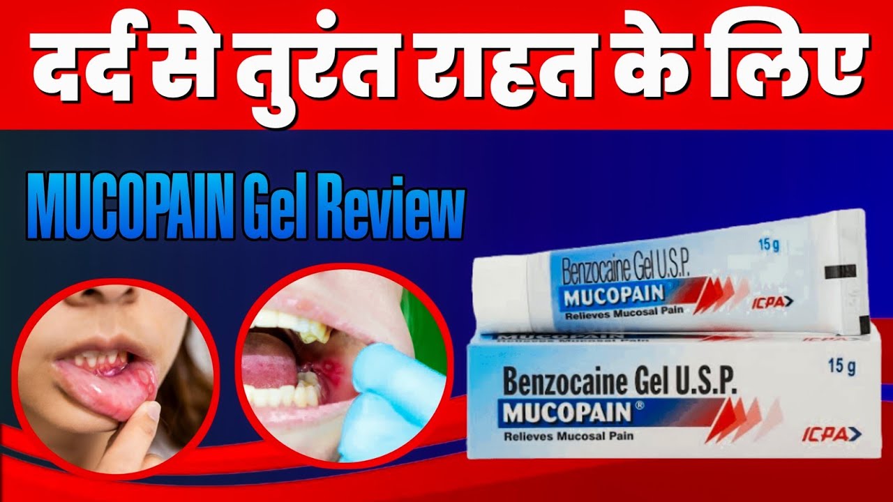 Use Of Mucopain Gel For Mouth Ulcer | Benzocaine Gel USP Mucopain Uses ...