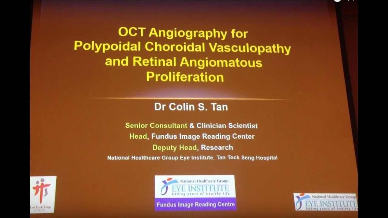 OCT A workshop Sing 2016 OCTA in PCV & RAP Colin Tan, Singapore - YouTube