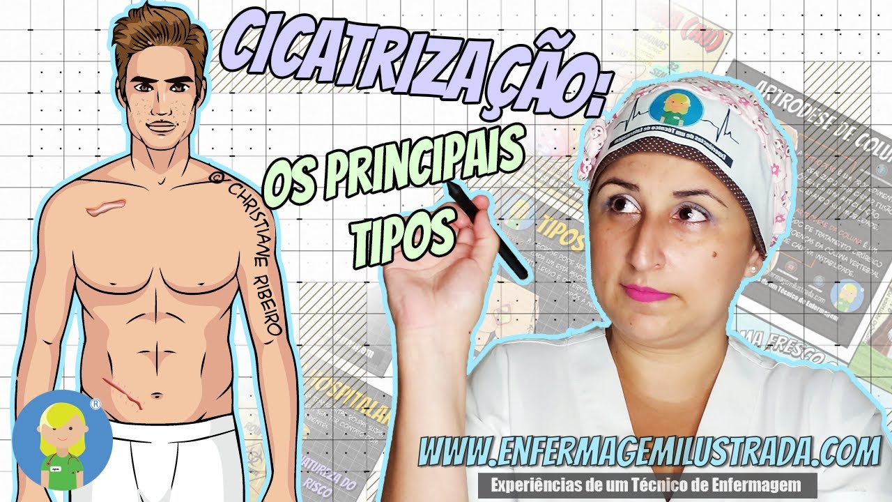 CICATRIZES: Você está familiarizado com os principais TIPOS? - YouTube