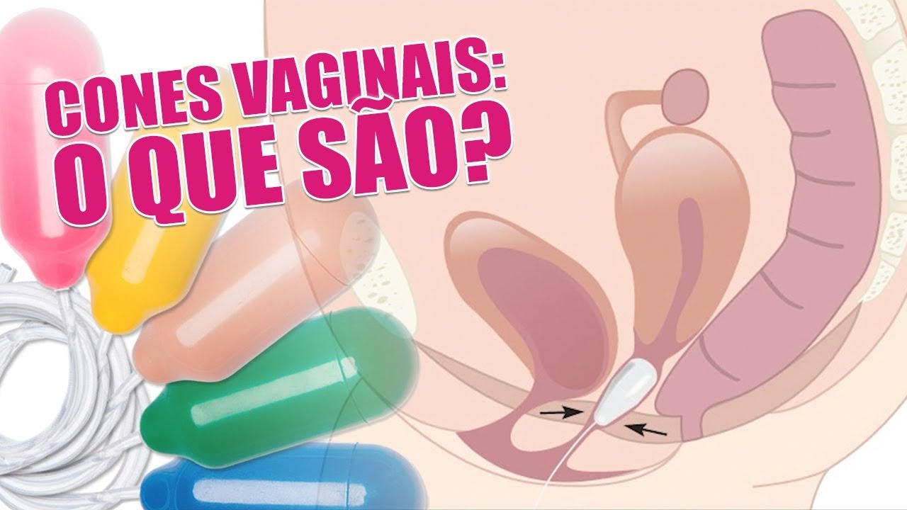 Cone Vaginal para que servem? Ajudam na diástase? Especialistas explicam. - YouTube