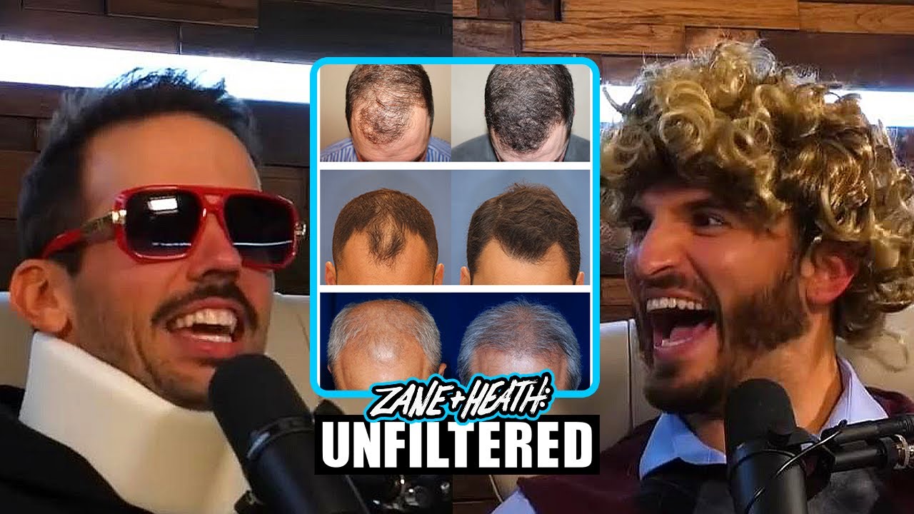 ZANE & HEATH DISCUSS THEIR HAIR TRANSPLANTS - YouTube