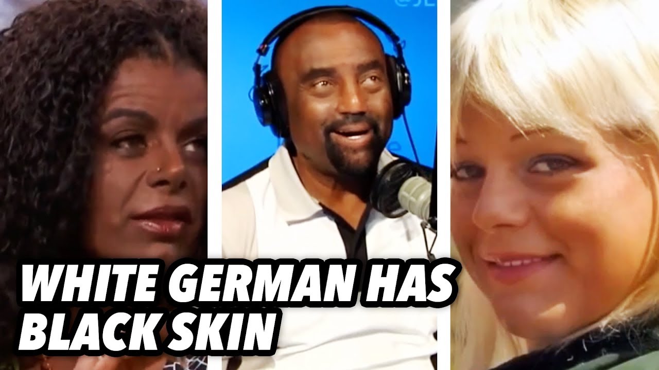 Black Woman's White Skin is HISTORY! - YouTube