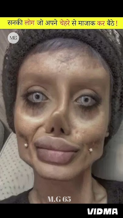 Aesi Sanki log jo Plastic surgery krwa k Bht badi galti kar baithe #shorts - YouTube