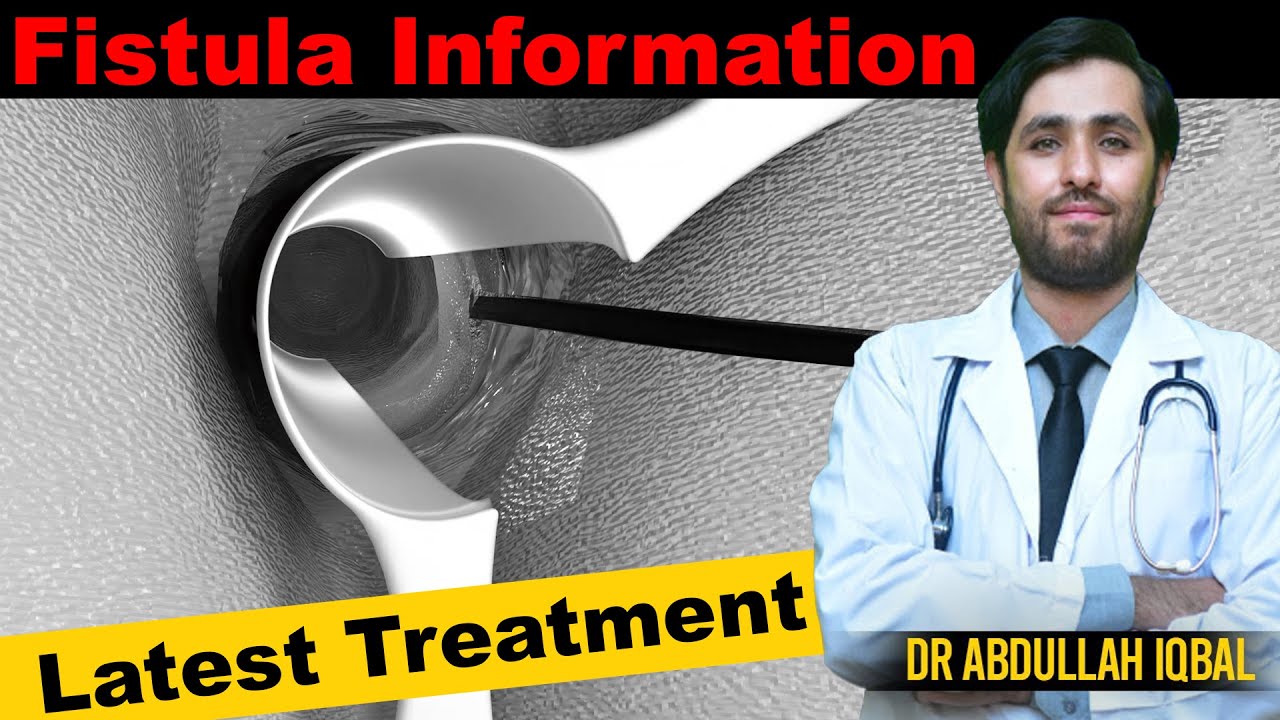 What is Meaning of Fishtula? Latest Advancement in Anal Fistula ...