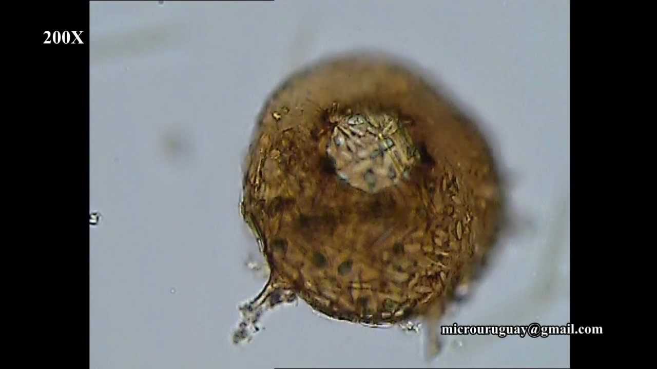 Centropyxis aculeata ameba testada - testate amoeba - YouTube