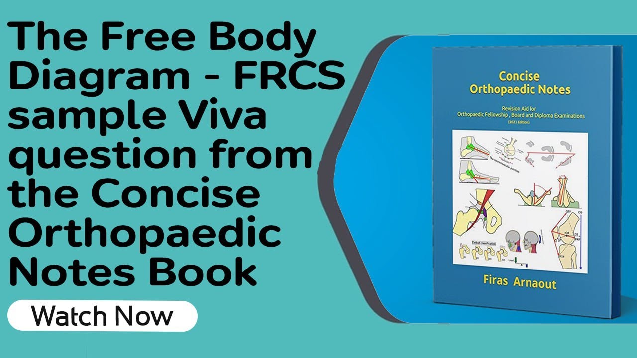 The Free Body Diagram - FRCS sample Viva question from the Concise ...