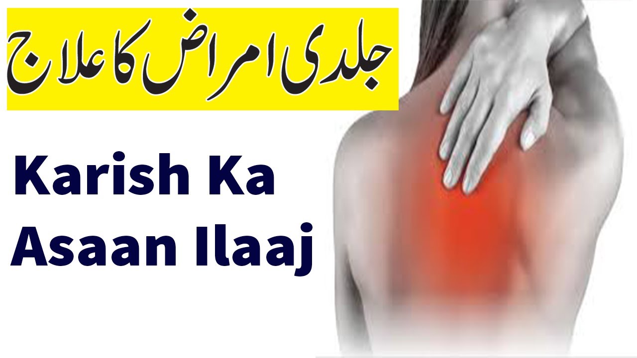 Treatment Of Itching In Urdu | Khushak Kharish Ka Gharlu Ilaj - YouTube