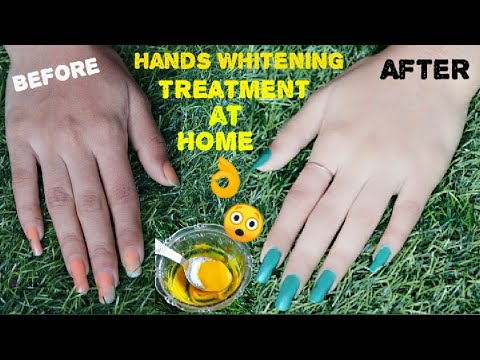 Skin Whitening | Hand Skin Whitening Remedy | Hands Whitening Treatment ...