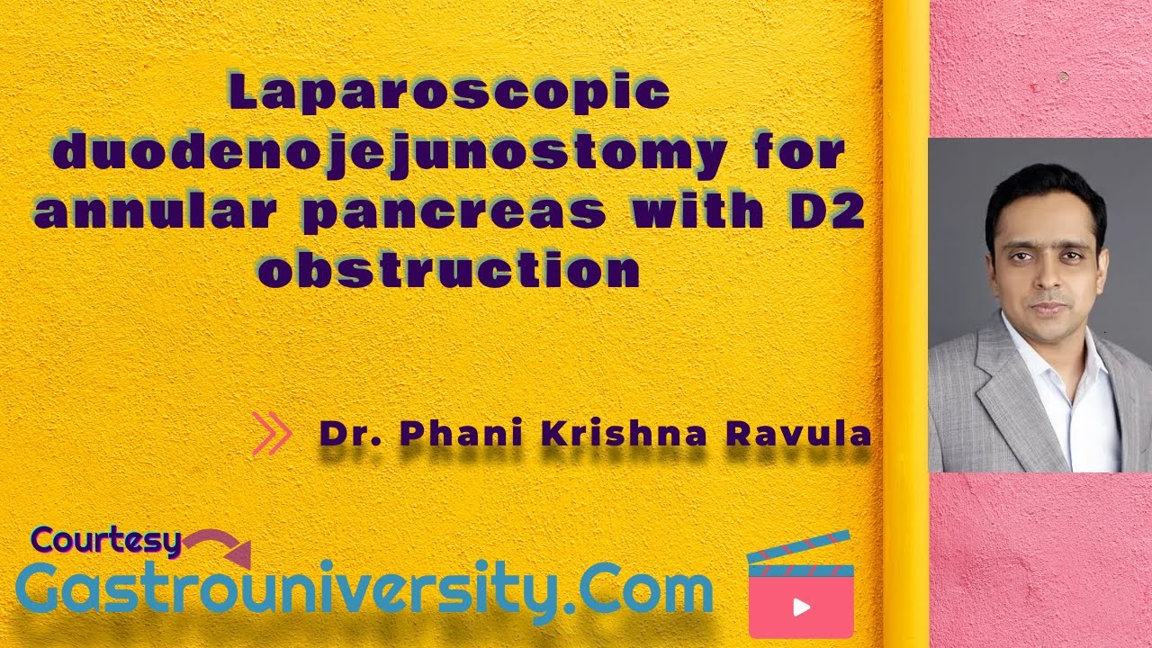 Pancreas-Laparoscopic duodenojejunostomy for annular pancreas with D2 ...