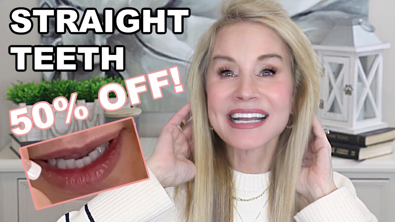 My BYTE INVISIBLE BRACES Journey | 8 MONTH UPDATE! | Before & After ...