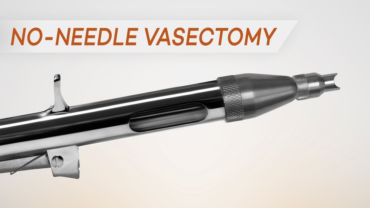 Vasectomy: No Needles, No Scalpels, No Discomfort - YouTube