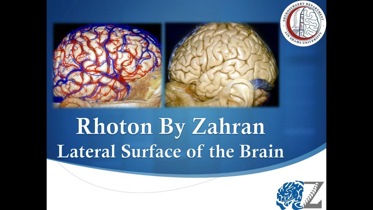 Rhoton By Zahran (4): Lateral Surface of the Brain - YouTube
