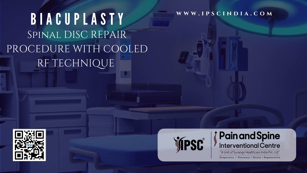 Biacuplasty: Disc annuloplasty with cooled RF - YouTube